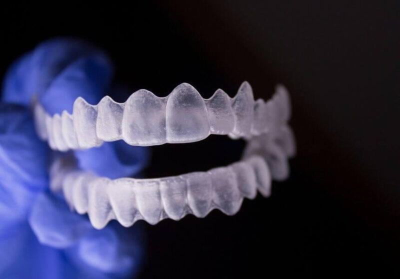Invisalign Moderate | Precios, Antes y Después - P&P Clinic