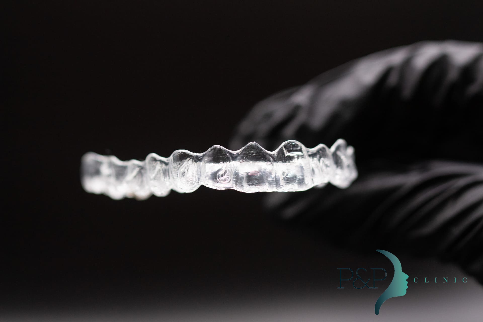 Invisalign Express en Madrid | Resultados | Precio | P&P Clinic